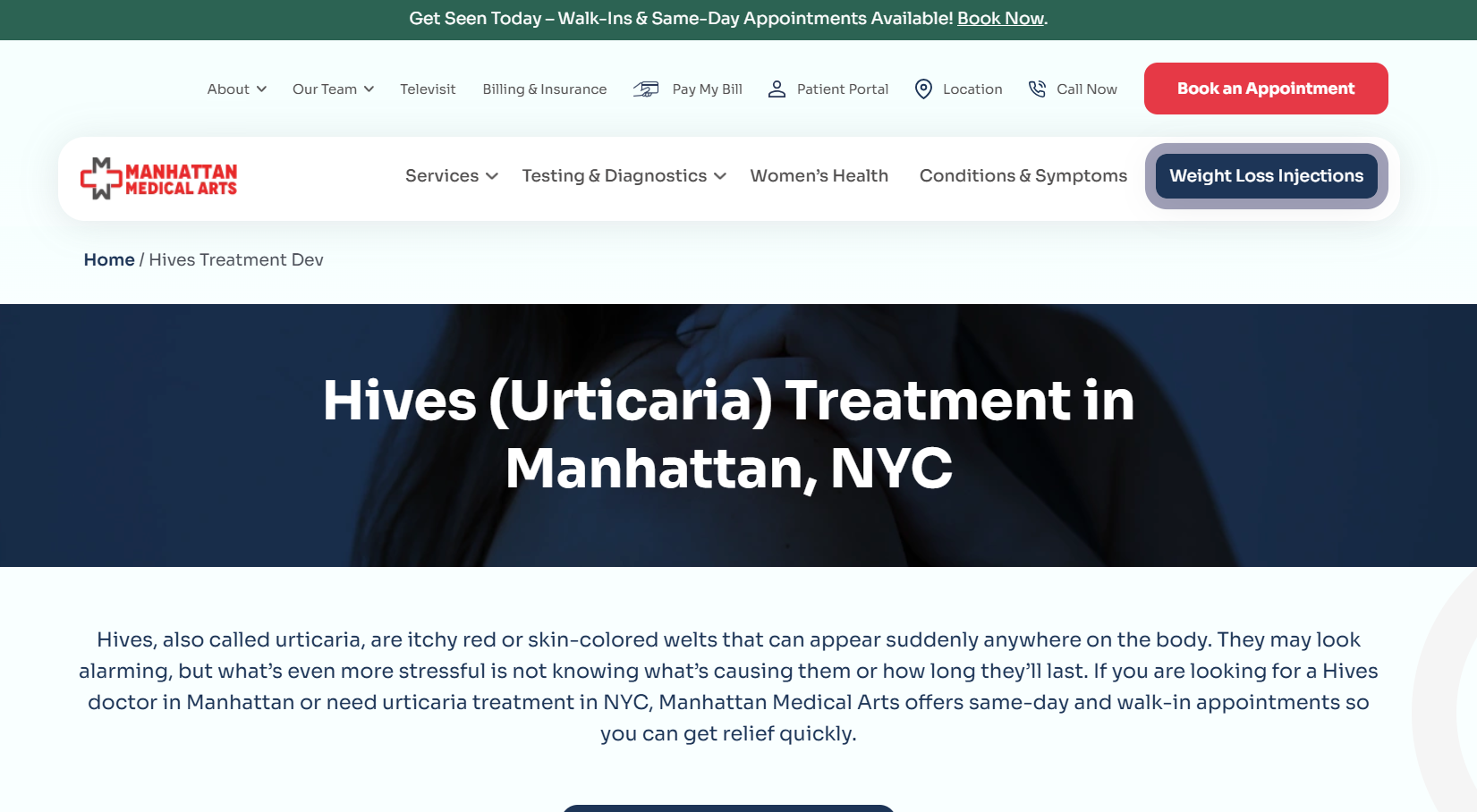 Hives (Urticaria) Treatment in Manhattan, NYC | Same-Day Doctor Visits